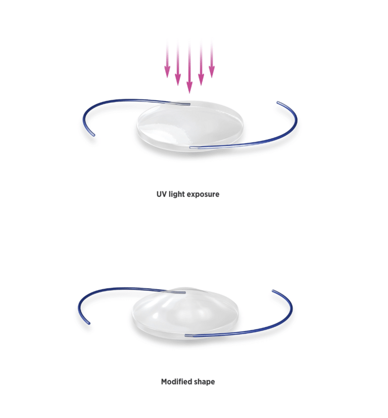 The First and Fully Adjustable Lens for Cataract Patients Naples ...